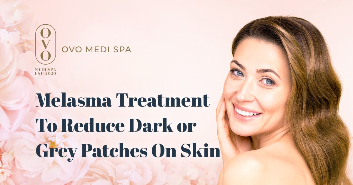 Melasma treatment to reduce dark or grey patches on skin